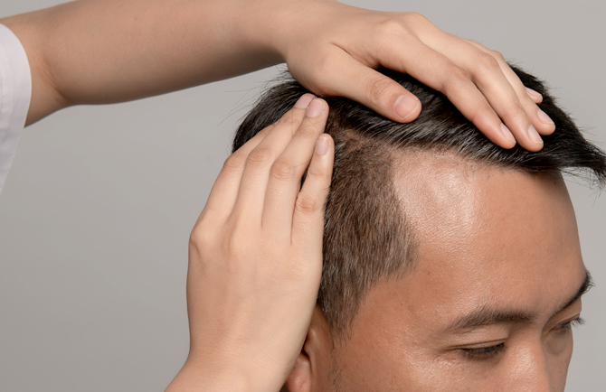 AGA/FAGA【HARG療法】 | 美容整形外科のジョウクリニック